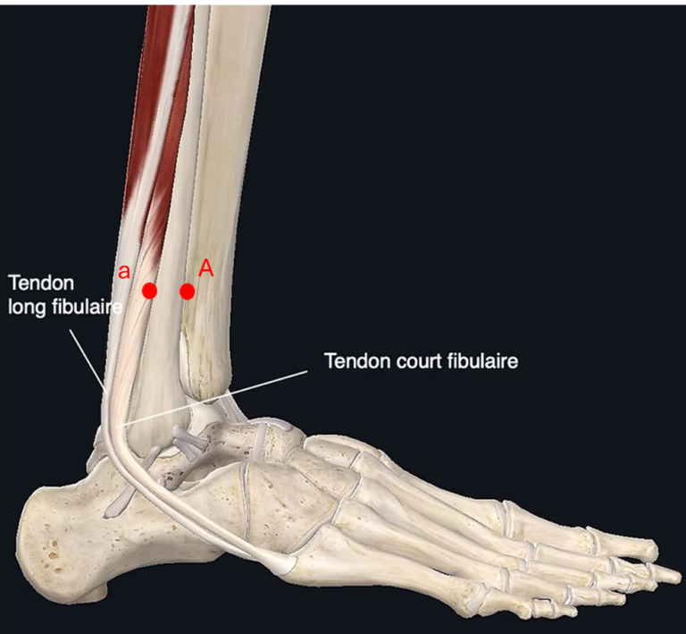 147- Les points fibulaires du méridien de la vésicule biliaire. - Gera